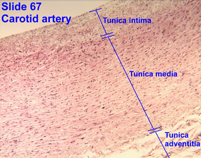 Aorta Slide Labeled